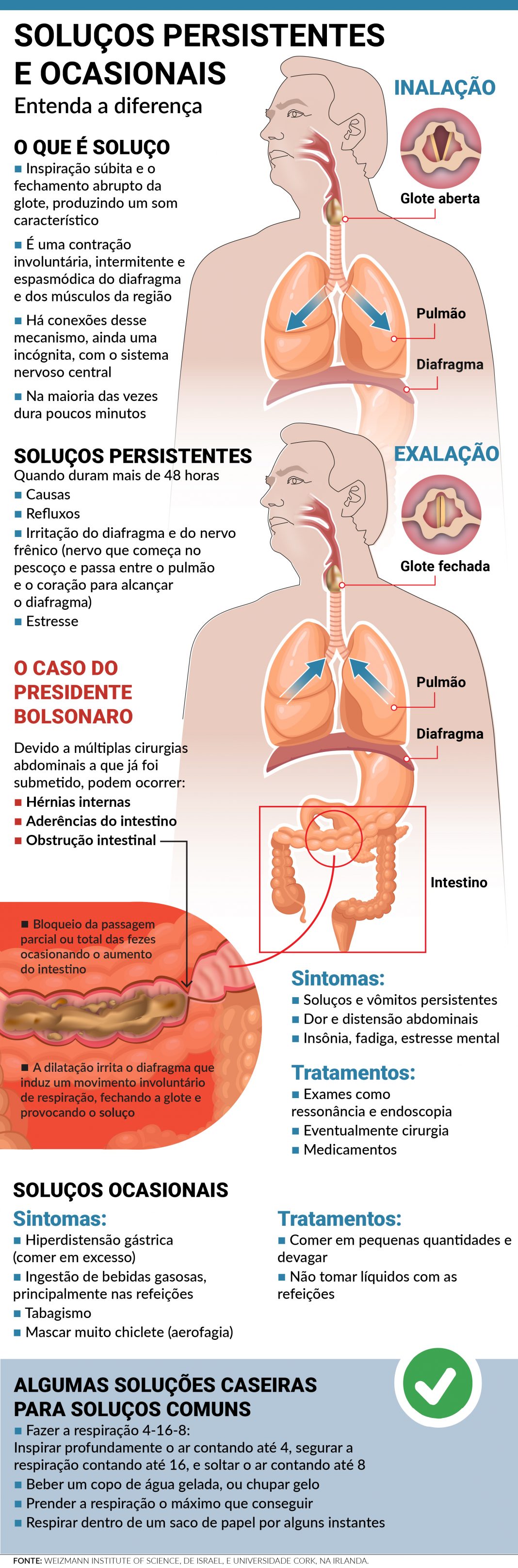 Soluço contínuo ou ocasional? Infográfico explica diferenças e o que ...